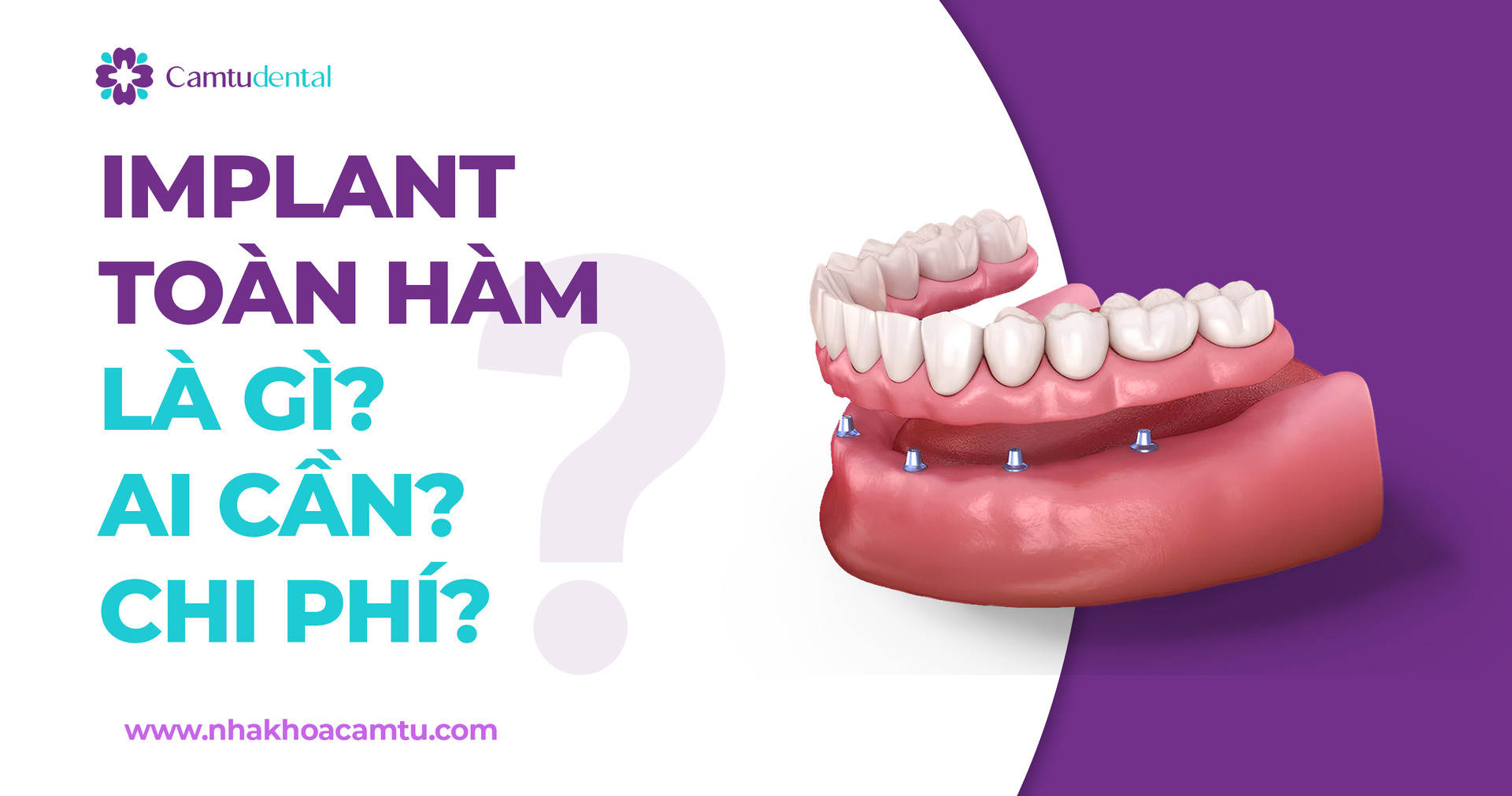 Implant toàn hàm là gì? Dành cho ai? Chi phí điều trị như thế nào? - Hệ ...