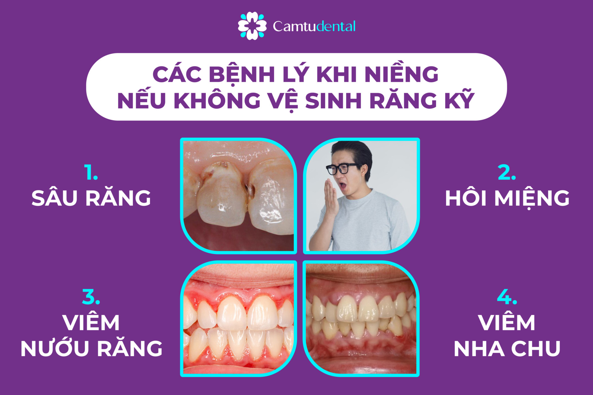 Lưu ý vệ sinh răng miệng cho bạn đang niềng răng - Hệ thống Nha khoa Cẩm Tú