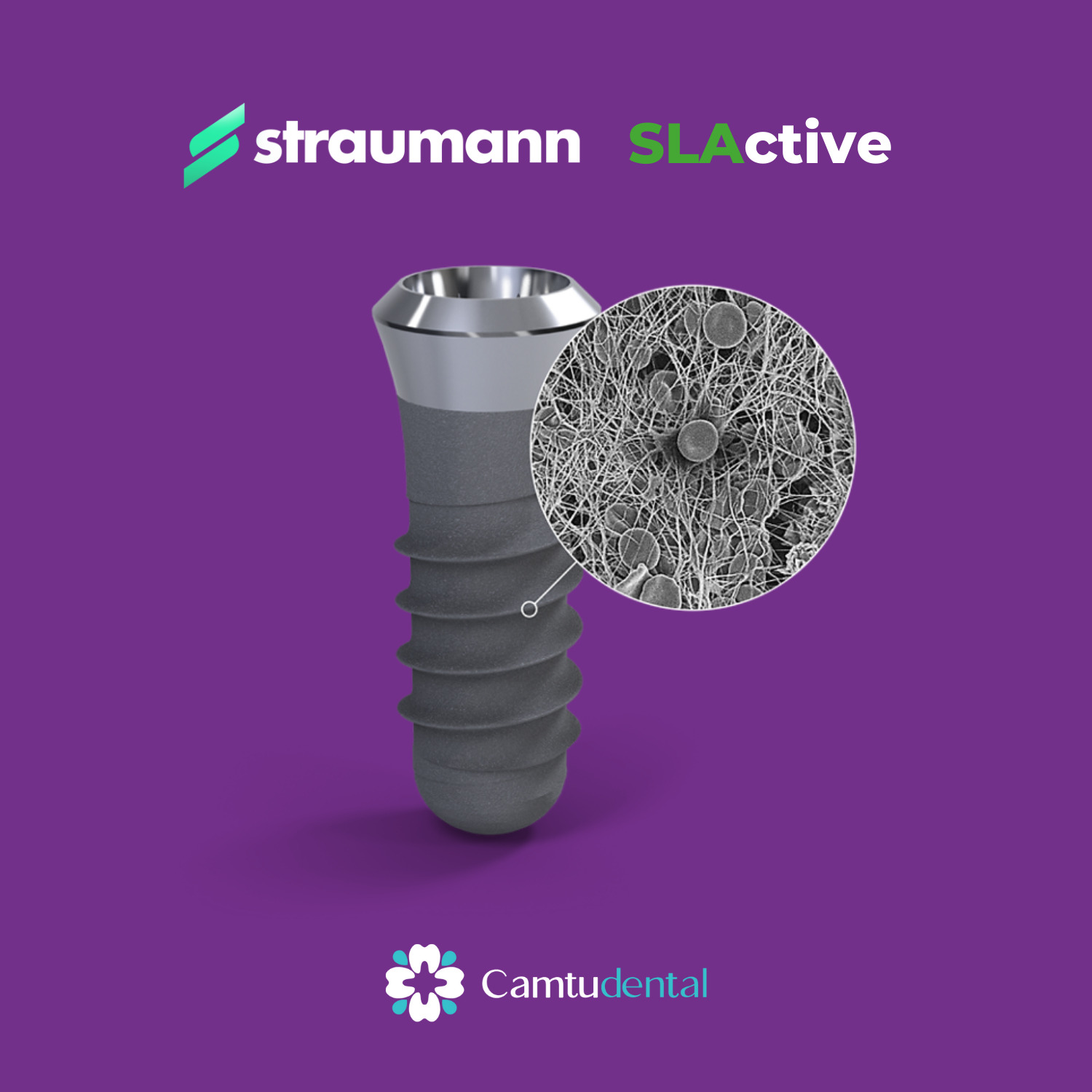 Implant Straumann - Tìm hiểu xuất xứ, ưu điểm và giá cả? - Hệ thống Nha ...